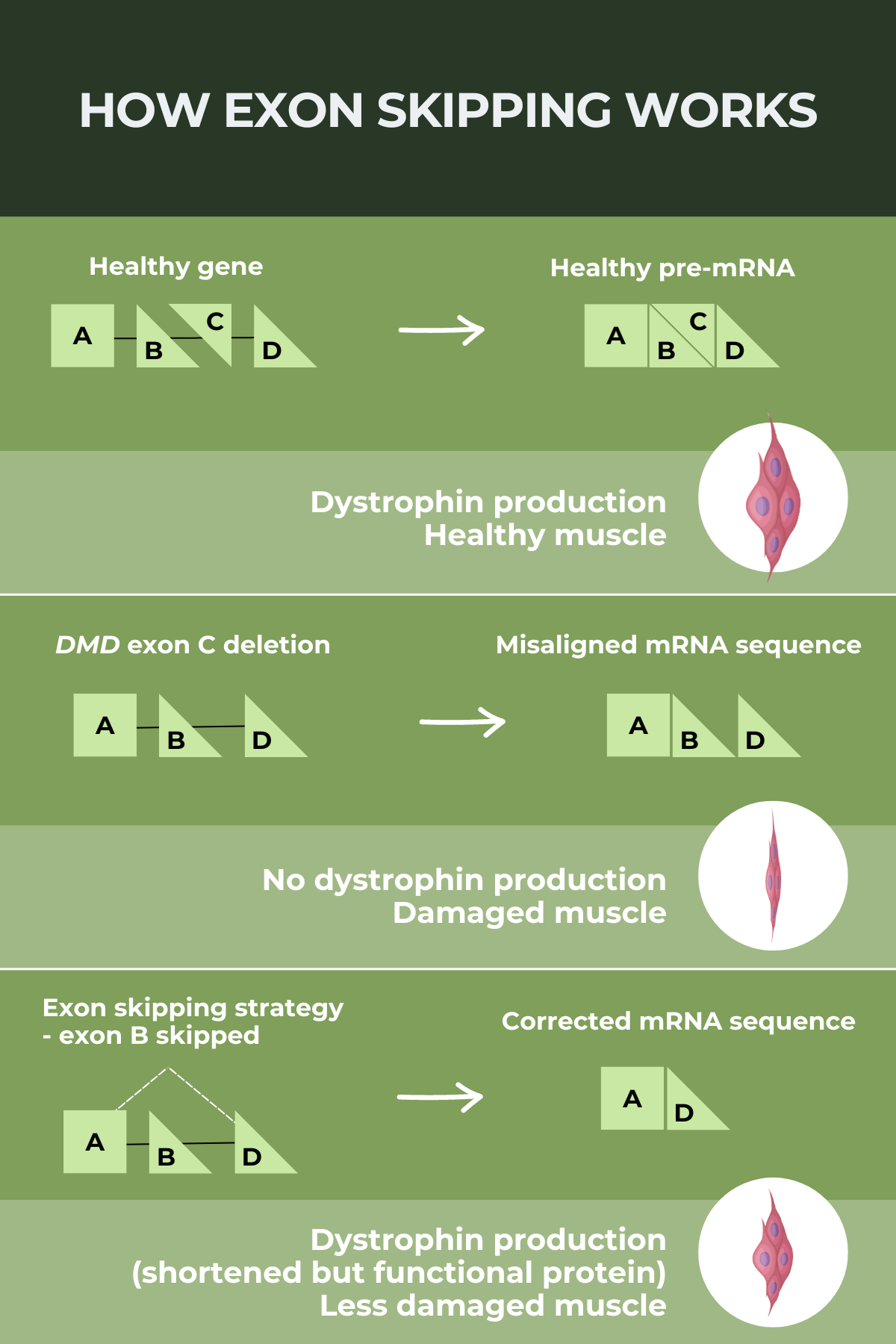 DMD treatment: Exon-skipping therapies | Muscular Dystrophy News