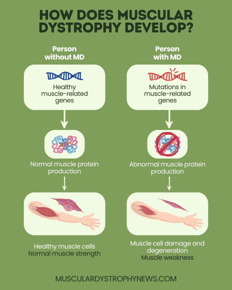Muscular dystrophy overview | Muscular Dystrophy News